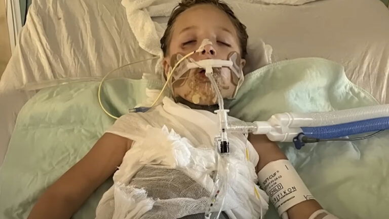 Microwaving NeeDoh Toy Lands Missouri Girl in Coma With Severe Burns ...